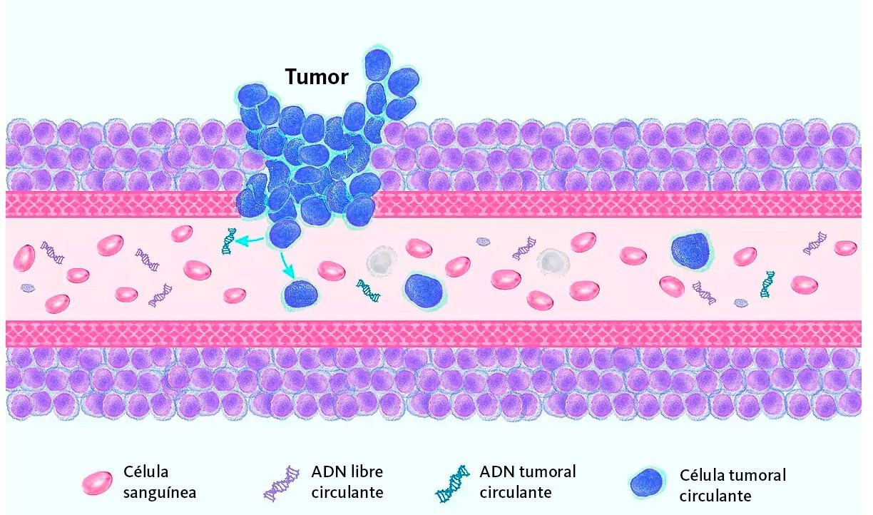 Un experto asegura que la biopsia líquida revolucionará el manejo ...